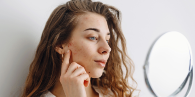 6 Effects Stress Can Have on Your Skin | BODi